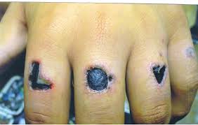 Cómo saber si un tatuaje está infectado: consejos y tips