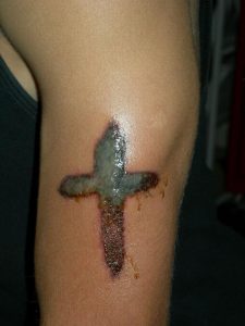 Cómo saber si un tatuaje está infectado: consejos y tips